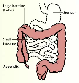 Appendicitis (Pediatric) | UCSF Department of Surgery